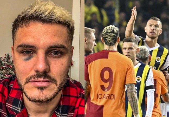 '미친 이스탄불 더비' 멍든 이카르디 논란 "완전히 조작됐어"vs"부끄럽지도 않냐?" - Kollo